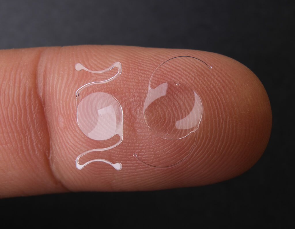 What Lens Implant Options Are Available For Refractive Lens Exchange In ...